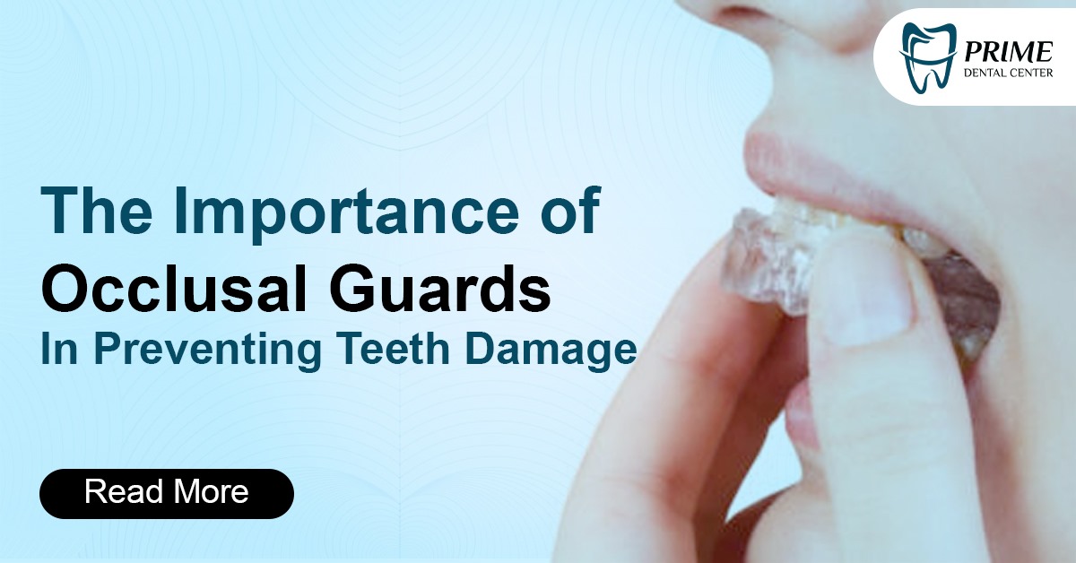 Custom Occlusal Guards for Teeth Grinding | Prime Dental Center